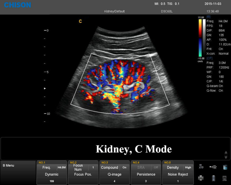 RENAL TRACT-KIDNEYS | SUMIT - Sydney Ultrasound Medical Imaging